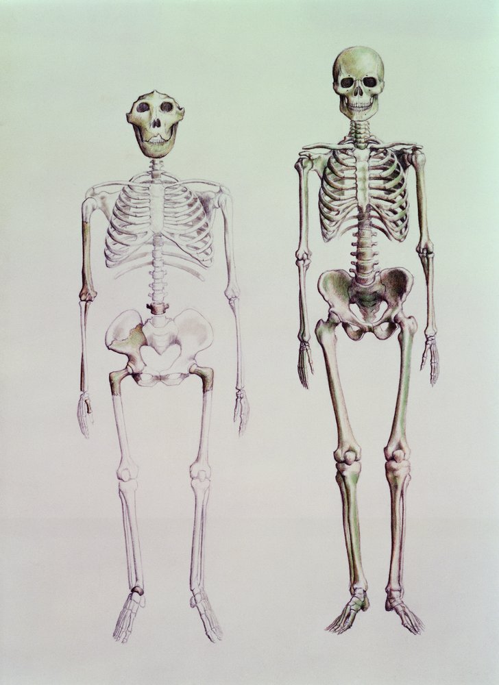 Australopithecus Boisei Características Del Cráneo