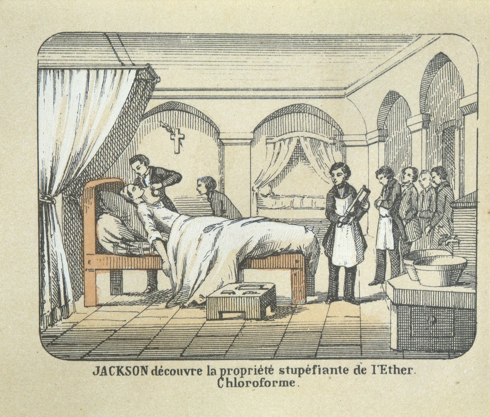 El Dr. Charles Jackson (1805-80) descubre las cualidades anestésicas del éter