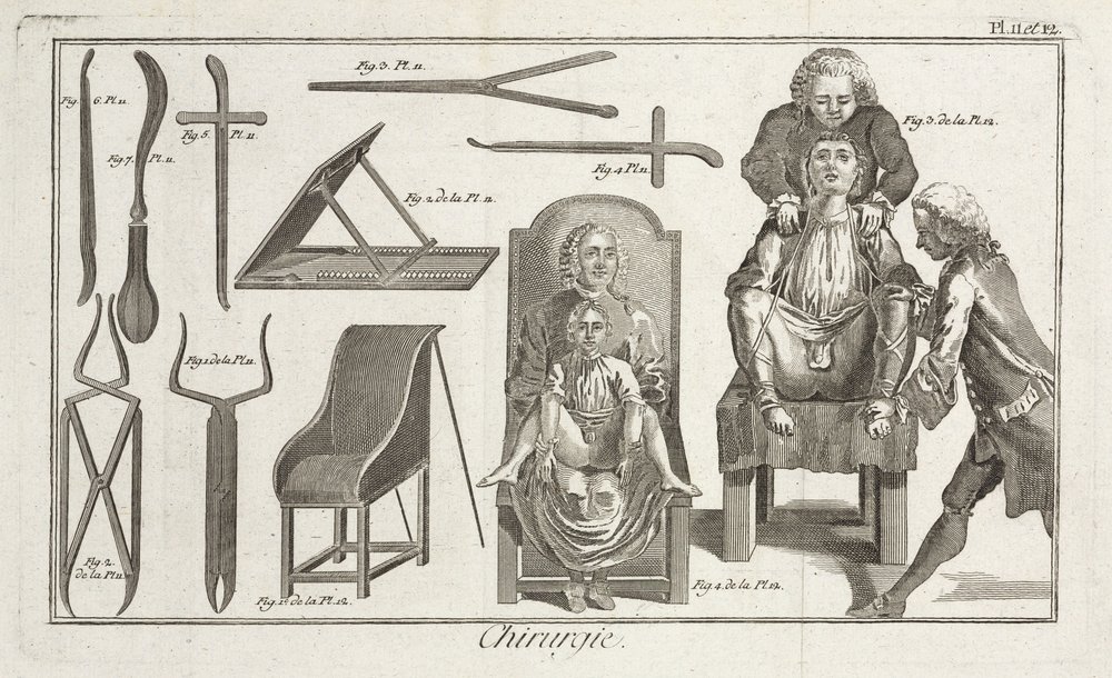 Cirujanos y pacientes de la era moderna temprana