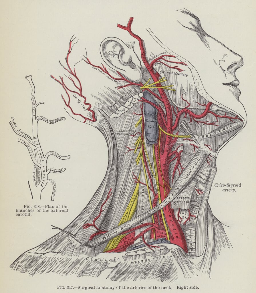 Anatomía quirúrgica de las arterias del cuello, lado derecho (grabado)