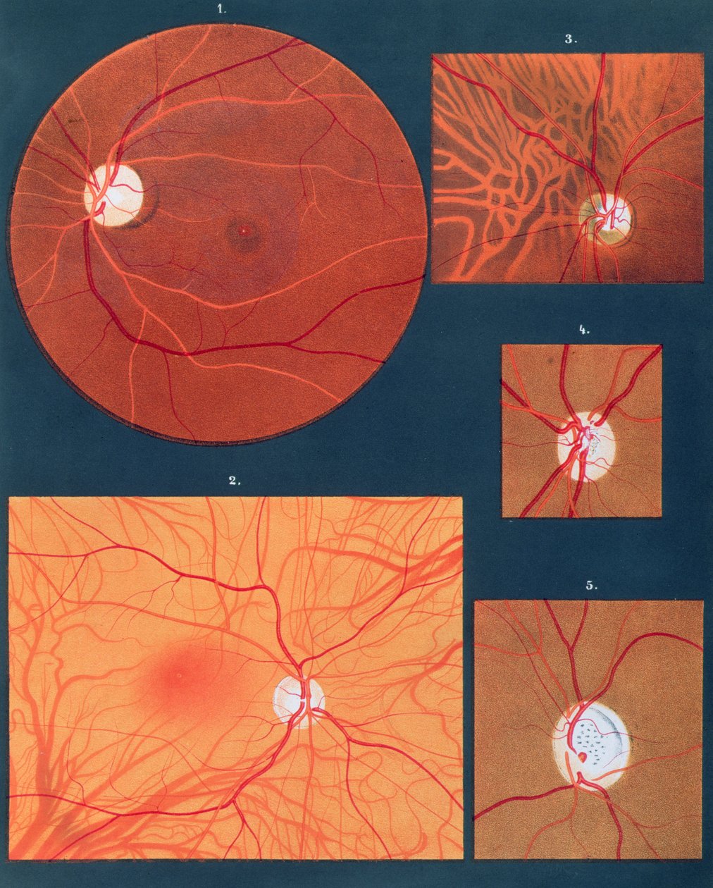 El ojo visto a través de un microscopio, de Atlas of Ophthalmoscopy ...